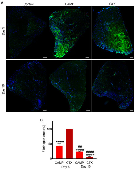 Toxins | Free Full-Text | Intramuscular Bleeding and Formation of ...
