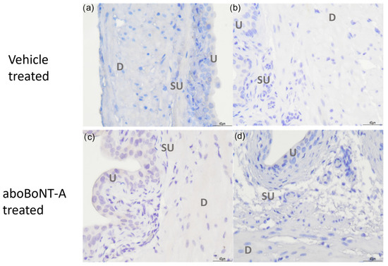 A Novel Catalytically Inactive Construct of Botulinum Neurotoxin A ...