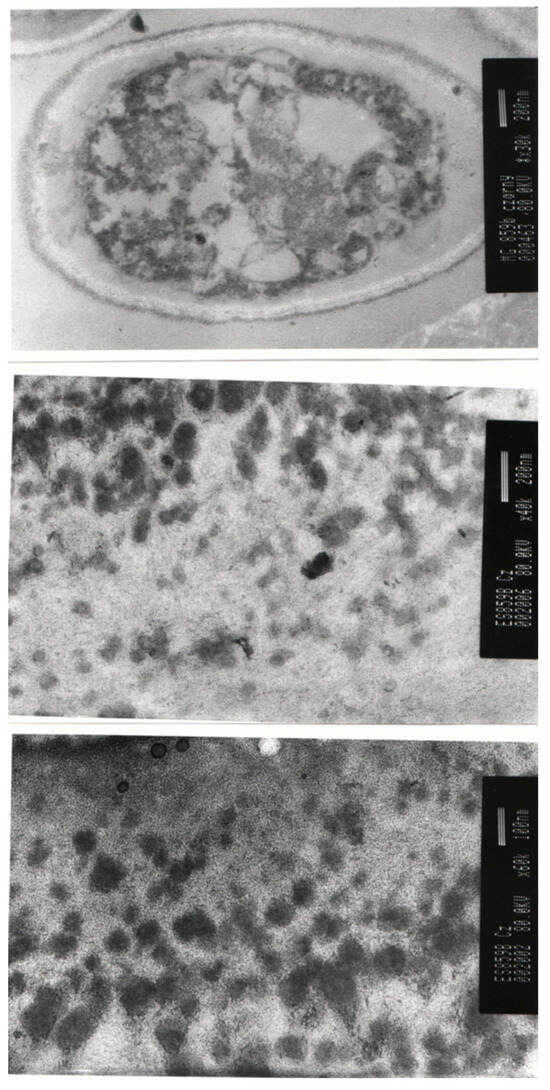 Adsorption of Zearalenone by Aureobasidium pullulans Autolyzed Biomass ...