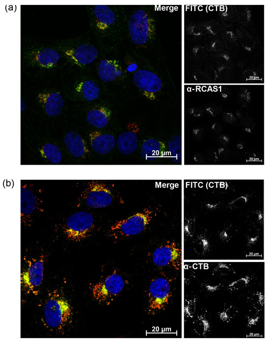 Sortase-Modified Cholera Toxoids Show Specific Golgi Localization