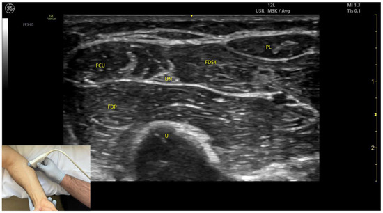 The Elias University Hospital Approach: A Visual Guide to Ultrasound ...