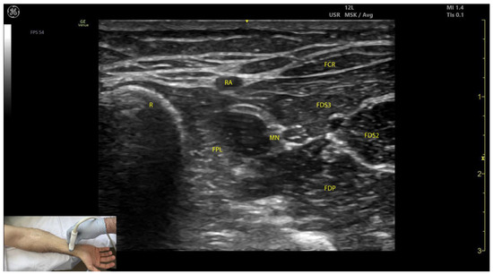 The Elias University Hospital Approach: A Visual Guide to Ultrasound ...