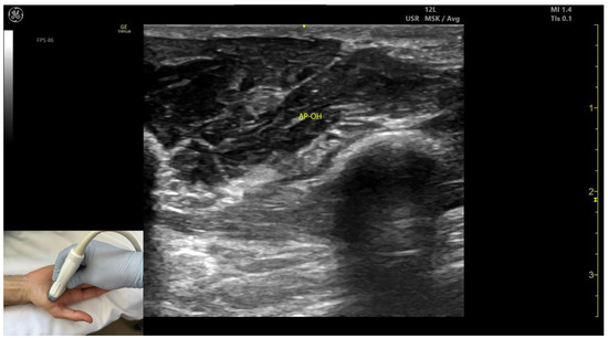 The Elias University Hospital Approach: A Visual Guide to Ultrasound ...