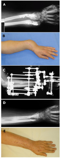 Trauma Care | An Open Access Journal from MDPI