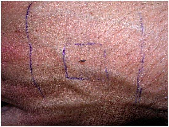 Orientation of Head Lice on Human Hosts, and Consequences for ...