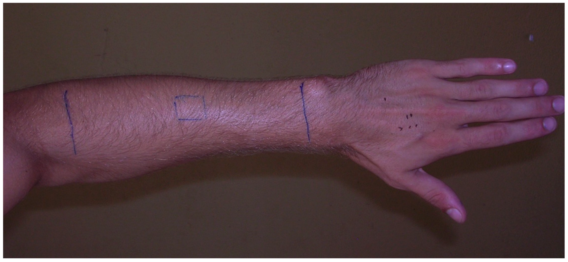 Orientation of Head Lice on Human Hosts, and Consequences for ...