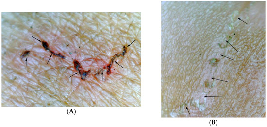 TropicalMed | Special Issue : Skin-Related Neglected Tropical Diseases ...