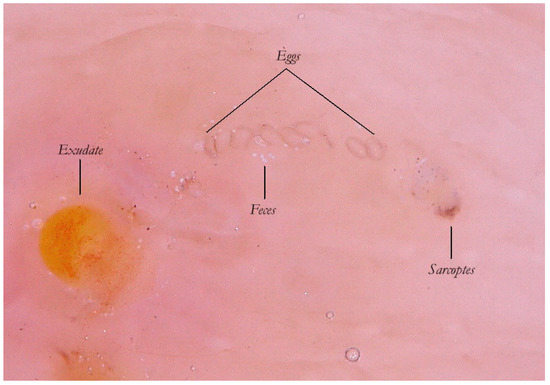 TropicalMed | Special Issue : Skin-Related Neglected Tropical Diseases ...