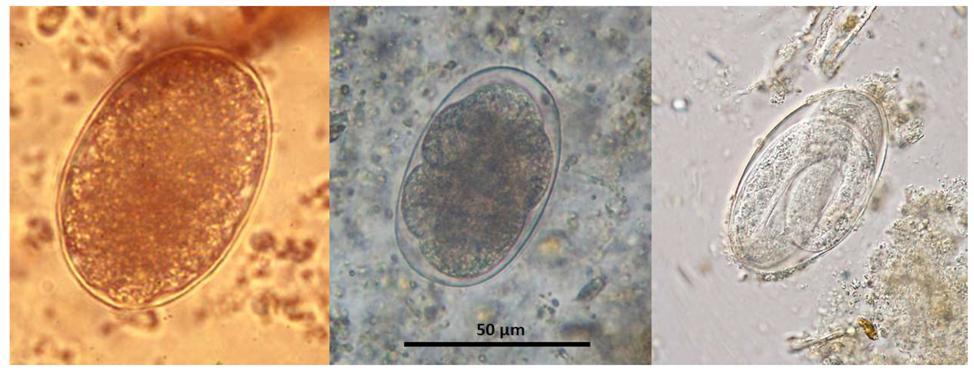 Ternidens deminutus Revisited: A Review of Human Infections with the ... Ternidens deminutus Revisited: A Review of Human Infections with the ...