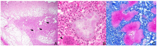 Cutaneous Pyogranulomas Associated with Nocardia jiangxiensis in a Cat ...
