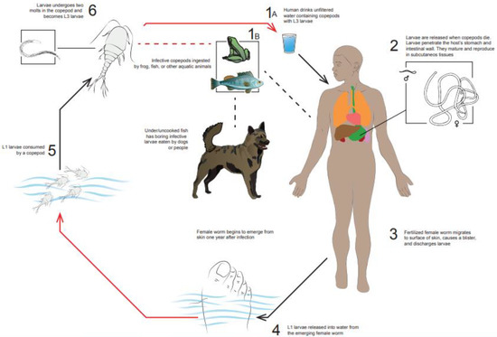 TropicalMed | Free Full-Text | Guinea Worm Disease: A Neglected ...