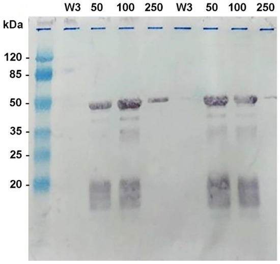 A Use of 56-kDa Recombinant Protein of Orientia tsutsugamushi Karp ...