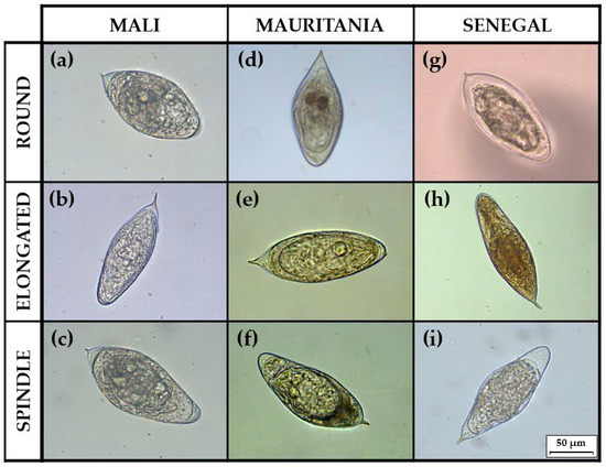 Schistosoma Mansoni Ova