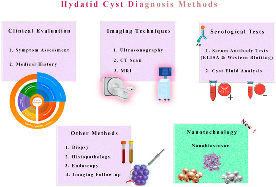Challenges and Prospective of Enhancing Hydatid Cyst Chemotherapy by Nanotechnology and the ...