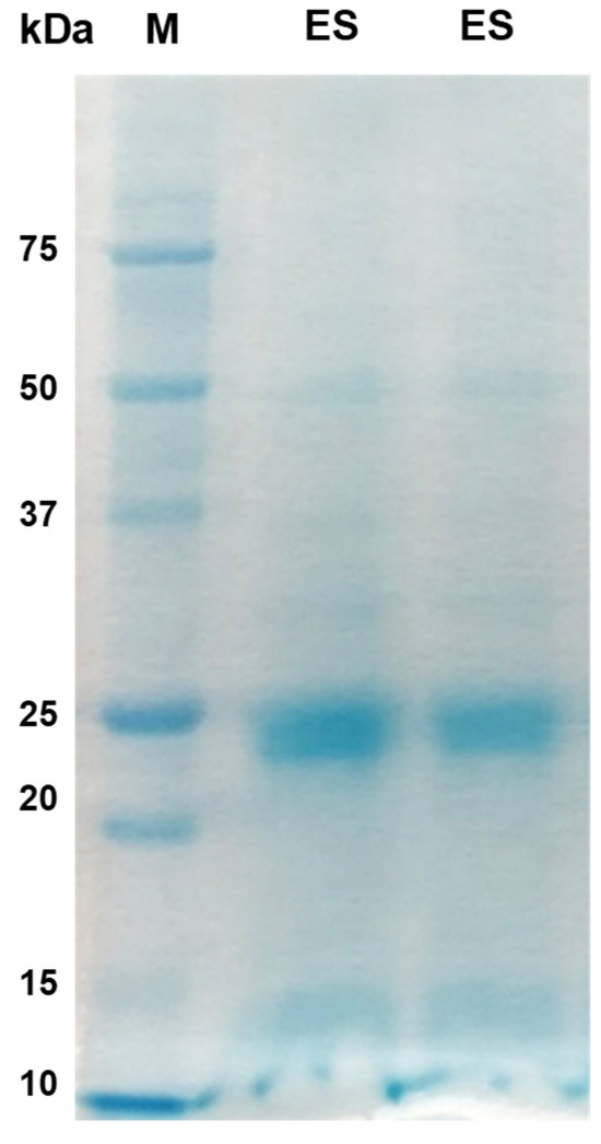 Immunoblotting Identification of Diagnostic Antigens of Paragonimus ...