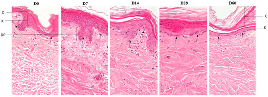 Human Skin as an Ex Vivo Model for Maintaining Mycobacterium leprae and ...