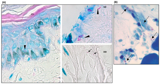 Human Skin as an Ex Vivo Model for Maintaining Mycobacterium leprae and ...