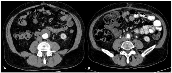 Uro | An Open Access Journal from MDPI