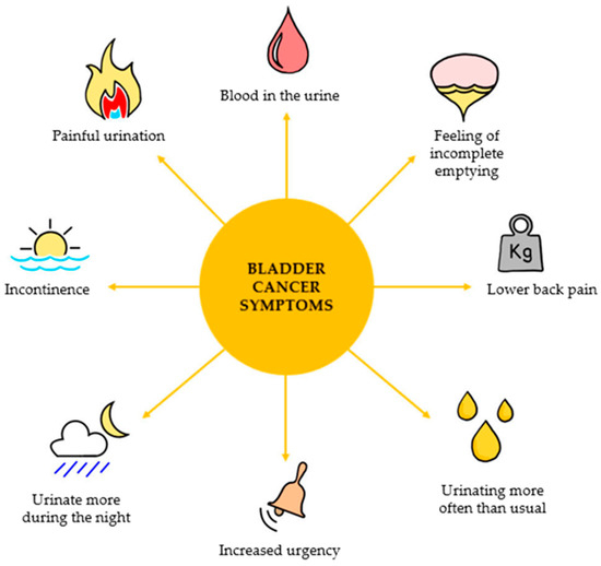 Bladder Cancer Basic Study and Current Clinical Trials