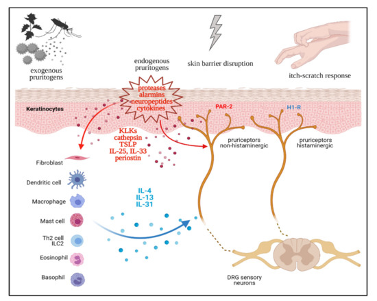 Pruritus as a Distinctive Feature of Type 2 Inflammation