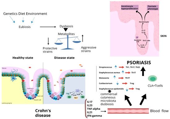 Vaccines | Free Full-Text | The Gut Microbiome in Psoriasis and Crohn’s ...