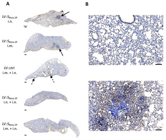 Full-Lung Prophylaxis against SARS-CoV-2 by One-Shot or Booster ...