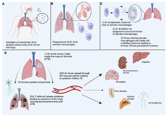 Role of B Cells in Mycobacterium Tuberculosis Infection