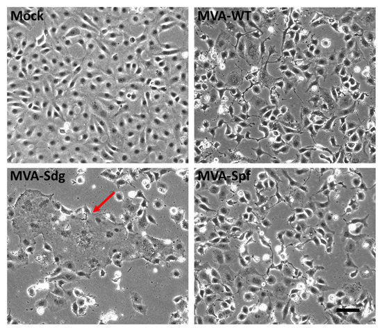 Vaccines | Free Full-Text | Vaccinia Virus Strain MVA Expressing a Prefusion-Stabilized SARS-CoV ...