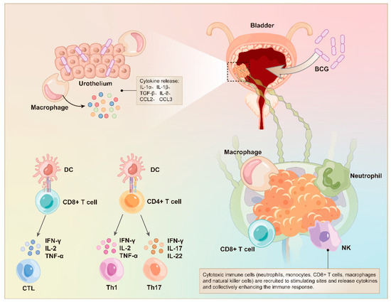 Bladder Cancer: Immunotherapy and Pelvic Lymph Node Dissection