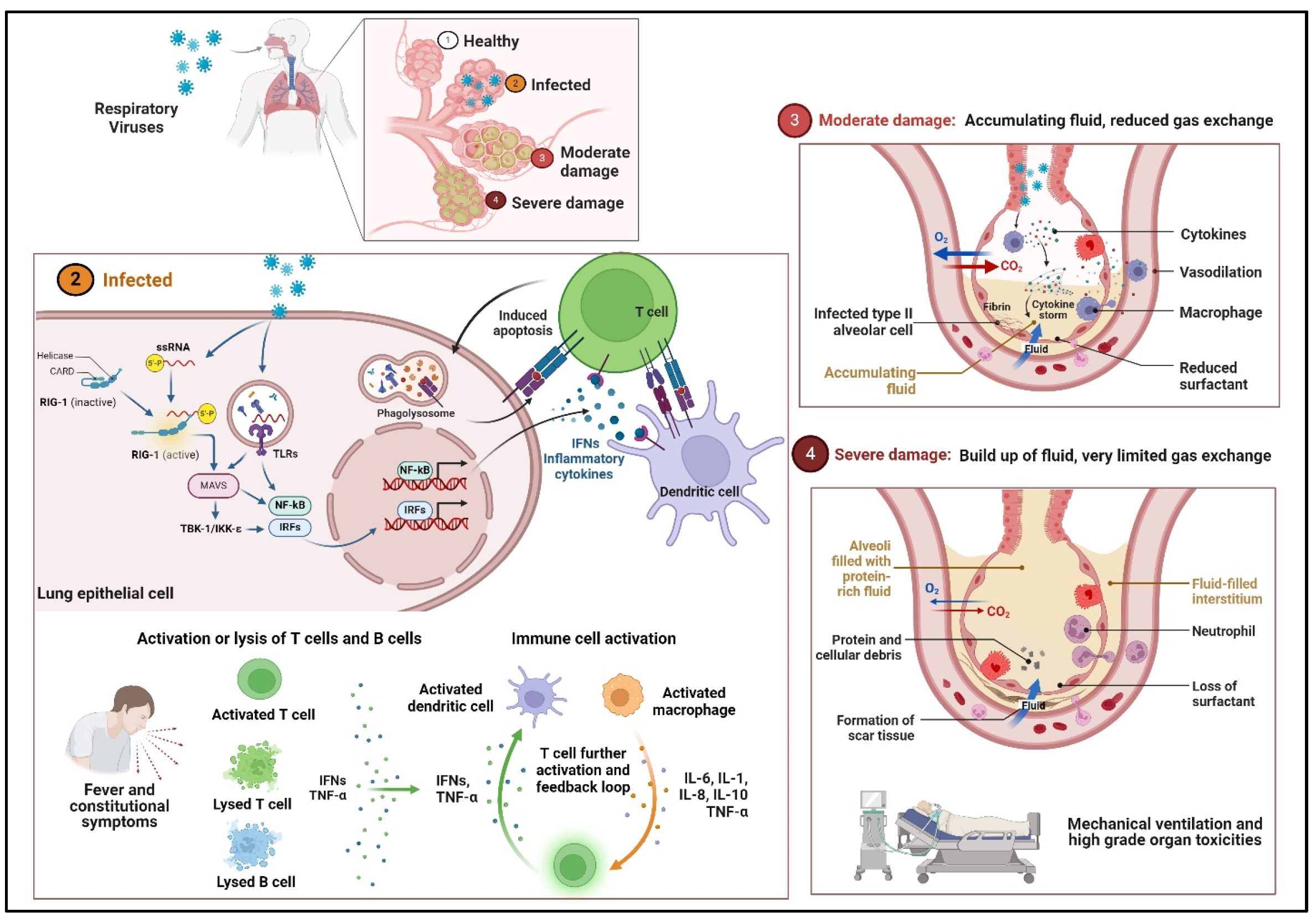 Vaccines for Respiratory Viruses—COVID and Beyond