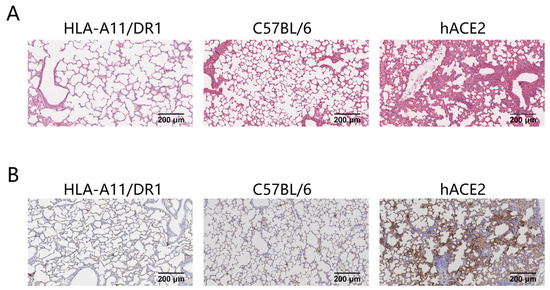 Humanized Major Histocompatibility Complex Transgenic Mouse Model Can ...