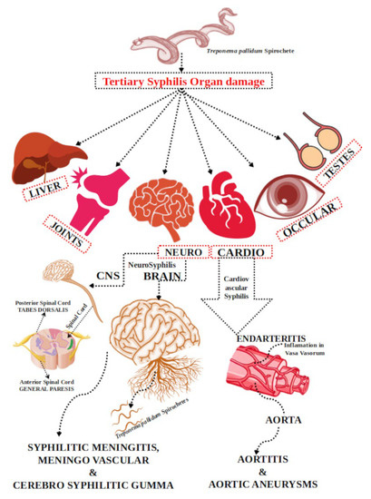 Neuroinformatics Insights towards Multiple Neurosyphilis Complications