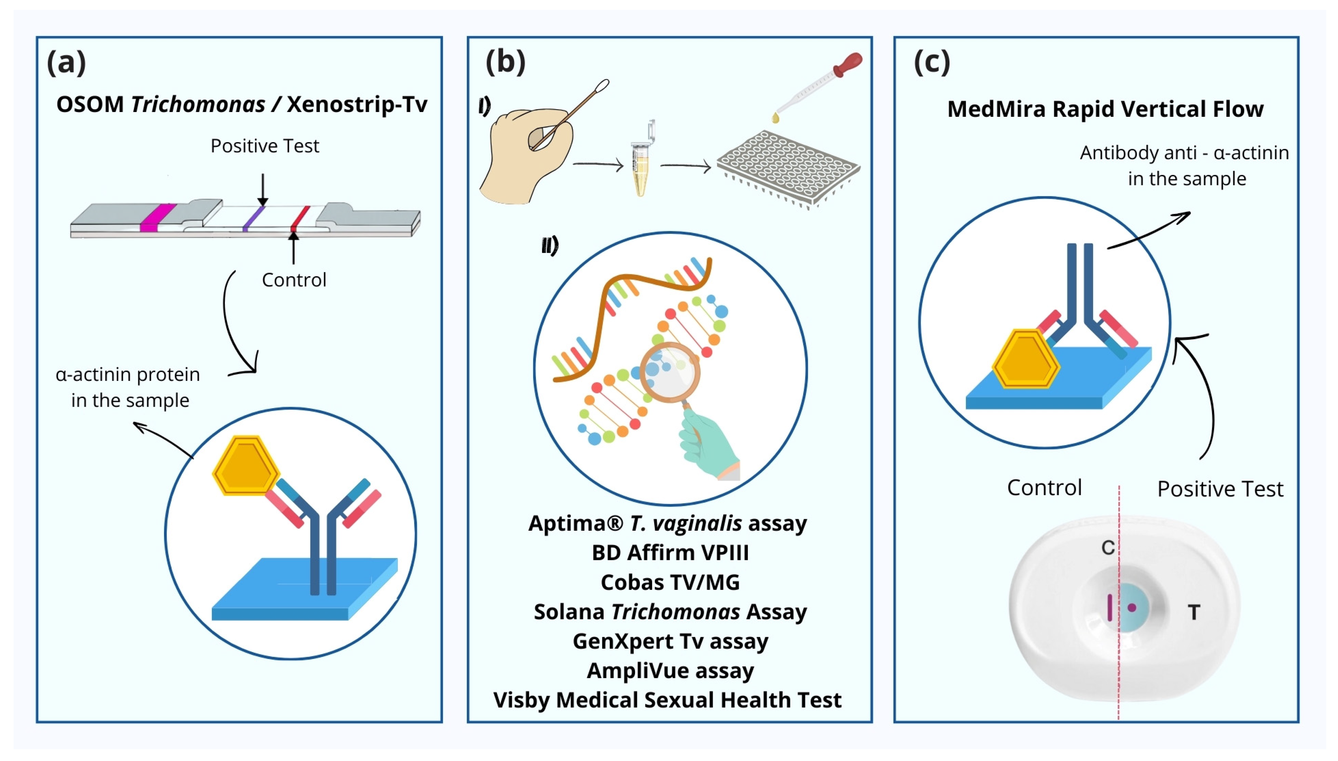 Point-of-Care Assays to Trichomonas vaginalis Diagnosis: The Road So Far