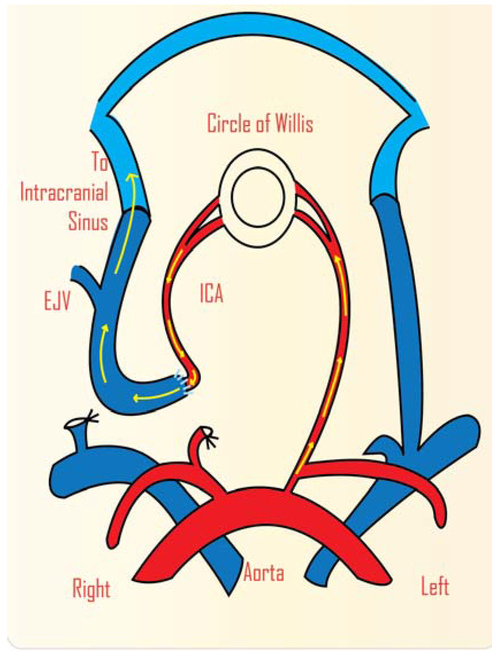 Experimental Animal Models of Arteriovenous Malformation: A Review