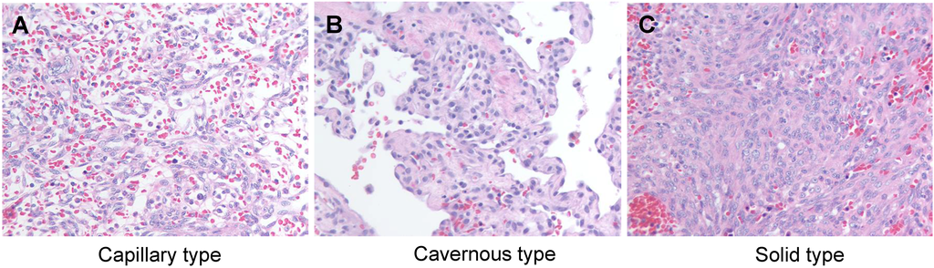 Pathobiology of Hemangiosarcoma in Dogs: Research Advances and Future ...