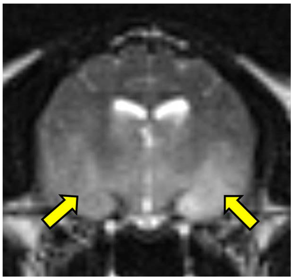 Gliomatosis Cerebri in the Brain of a Cat