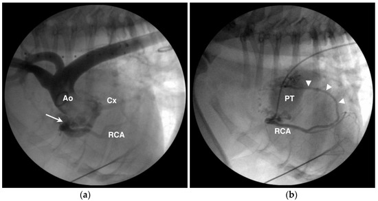Coronary Artery Anomalies in Animals