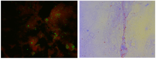 Application and Comparative Evaluation of Fluorescent Antibody ...
