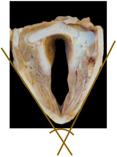 Anatomy and Pathology of the Texel Sheep Larynx