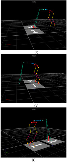 A Canine Gait Analysis Protocol for Back Movement Assessment in German ...