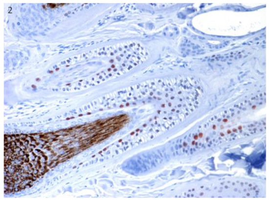 Canine Epithelial Skin Tumours: Expression of the Stem Cell Markers ...