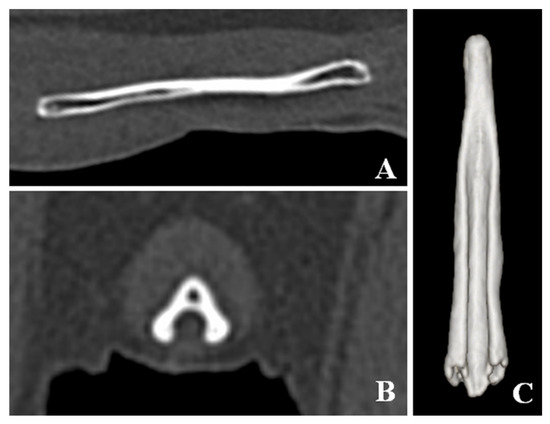 Dysuria Associated with Non-Neoplastic Bone Hyperplasia of the Os Penis ...