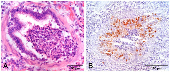 The Role of Pathology in the Diagnosis of Swine Respiratory Disease