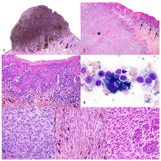Diagnosis and Prognosis of Canine Melanocytic Neoplasms