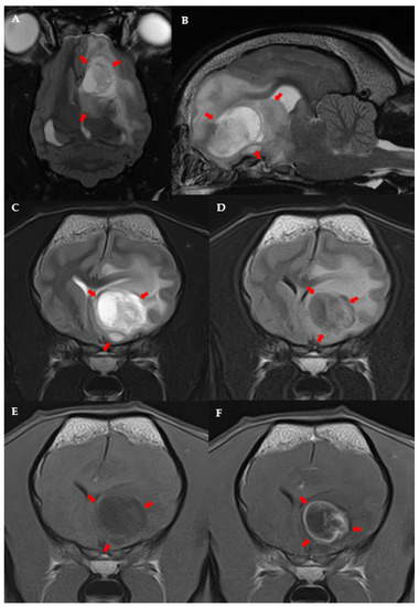 Clinical and Magnetic Resonance Imaging (MRI) Features, Tumour ...
