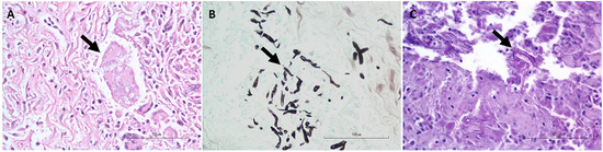 Nested PCR Detection of Pythium sp. from Formalin-Fixed, Paraffin ...