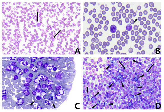 Mott Cell Differentiation in Canine Multicentric B Cell Lymphoma with ...