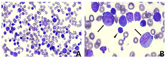 Mott Cell Differentiation in Canine Multicentric B Cell Lymphoma with ...
