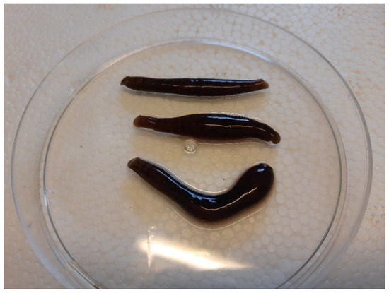 Morganella Morganii Infection in Hirudo Medicinalis (Iran): A Case Report