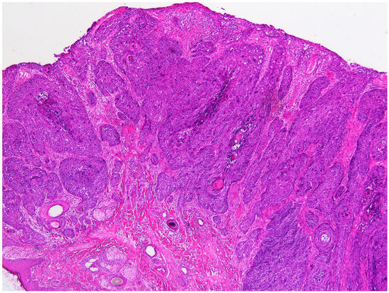Detection of a Novel Papillomavirus Type within a Feline Cutaneous ...